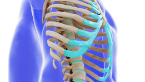 What is SRS | Slipping Rib Syndrome