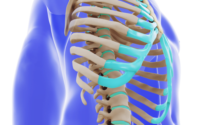 What is SRS | Slipping Rib Syndrome