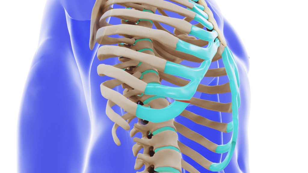 What is SRS | Slipping Rib Syndrome